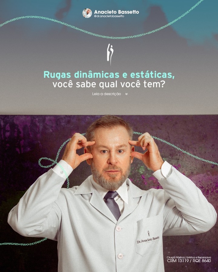 Tratamento de Rugas Dinâmicas e Estáticas em Curitiba | Anacleto